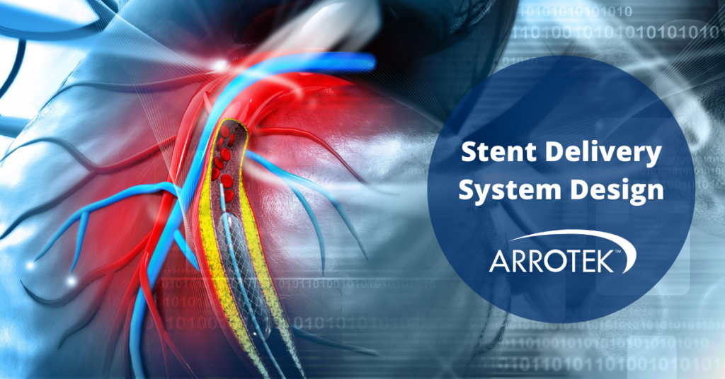 An Introduction to Stent Delivery System Design Considerations ...
